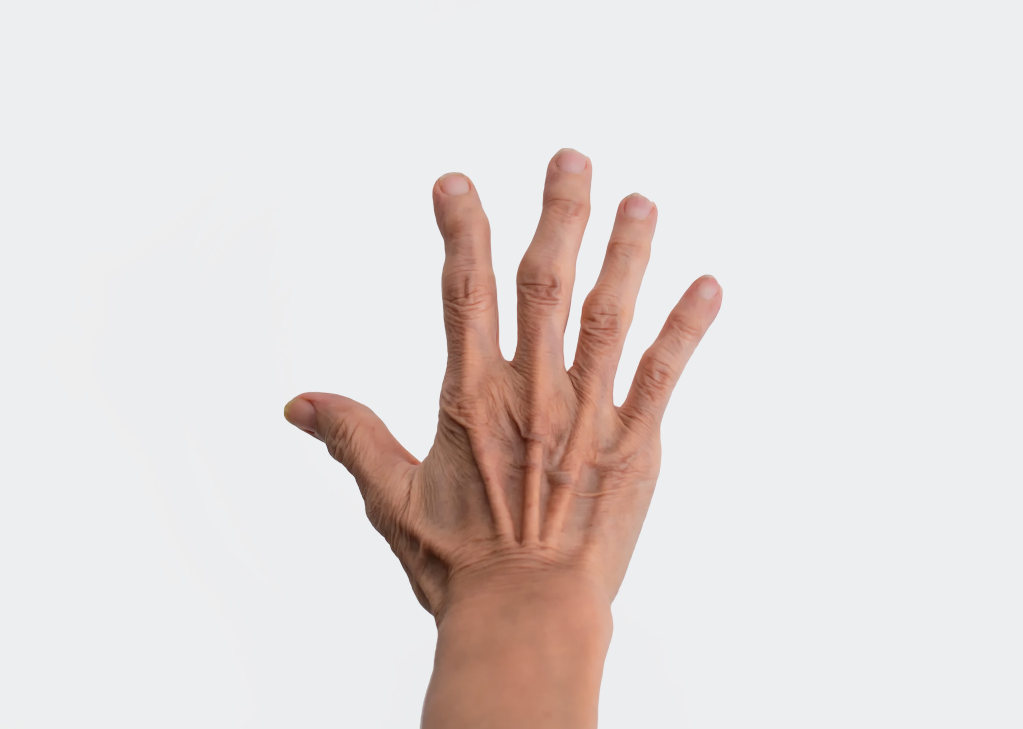Understanding Autoimmune Disease | UHealth Collective