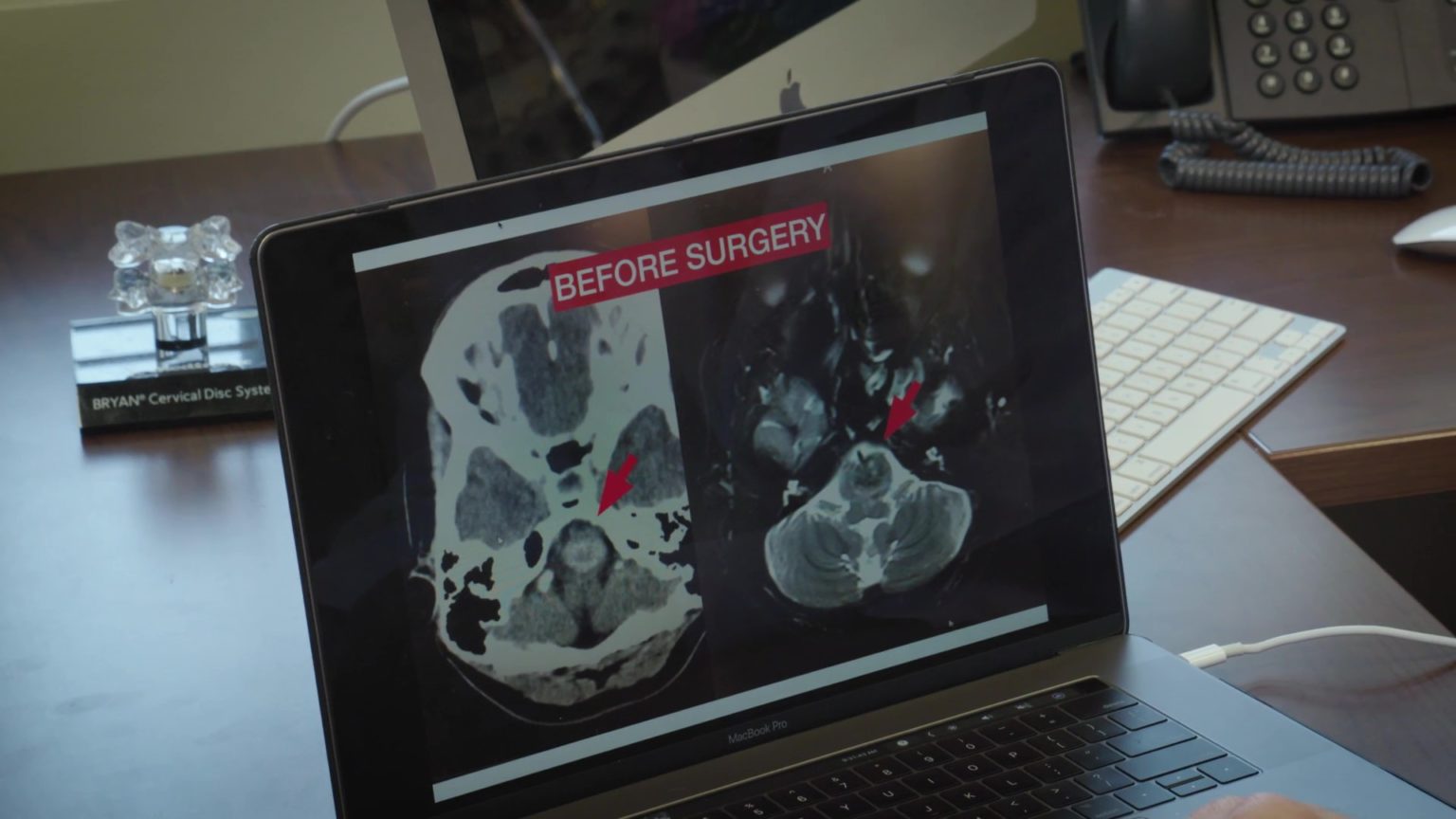 Focusing on You: Neurosurgery at University of Miami Health System ...