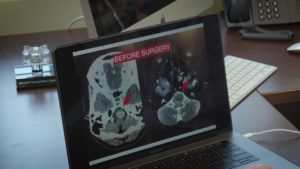 Focusing on You: Neurosurgery at University of Miami Health System ...